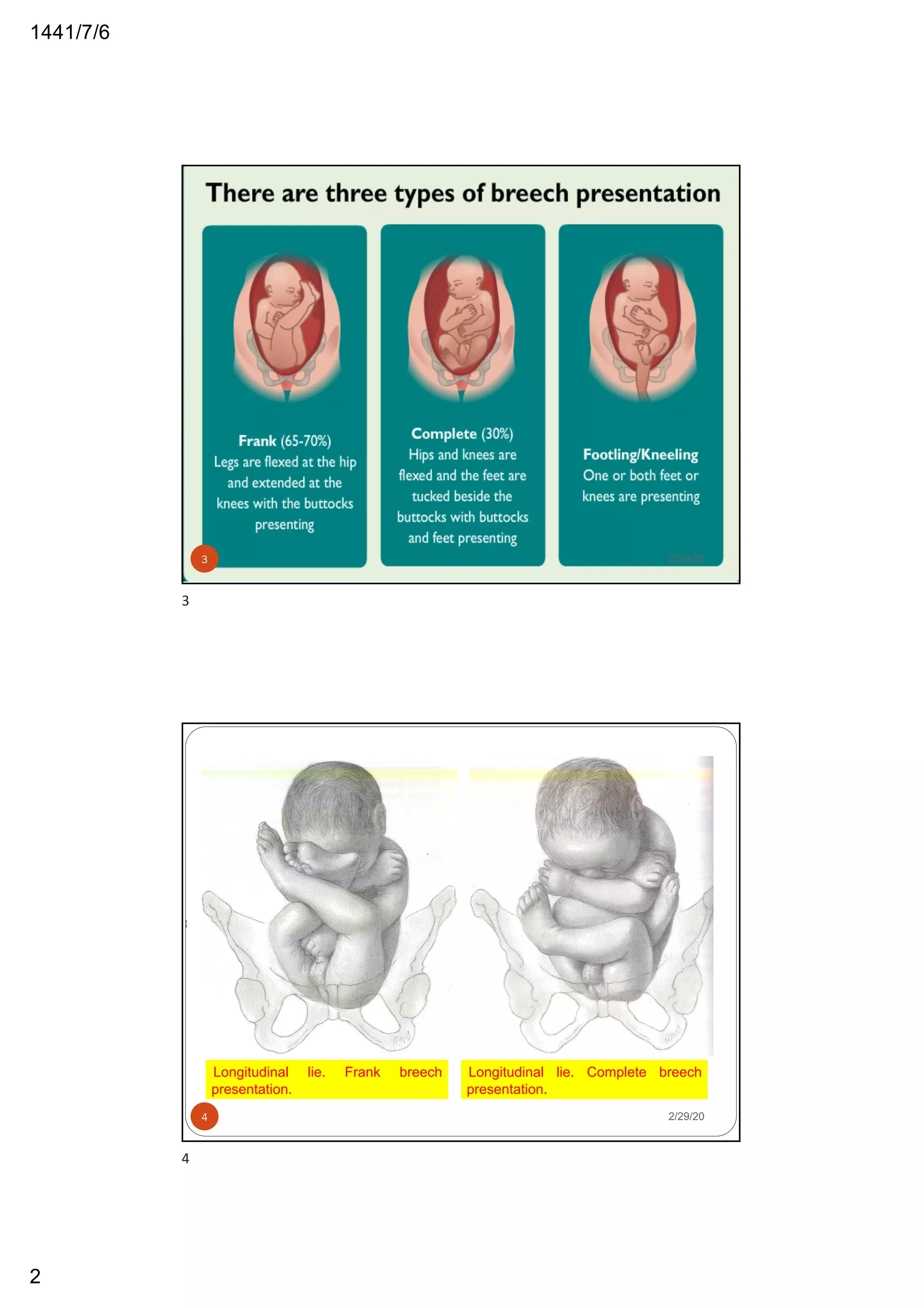3. abnormal presentations | PDF