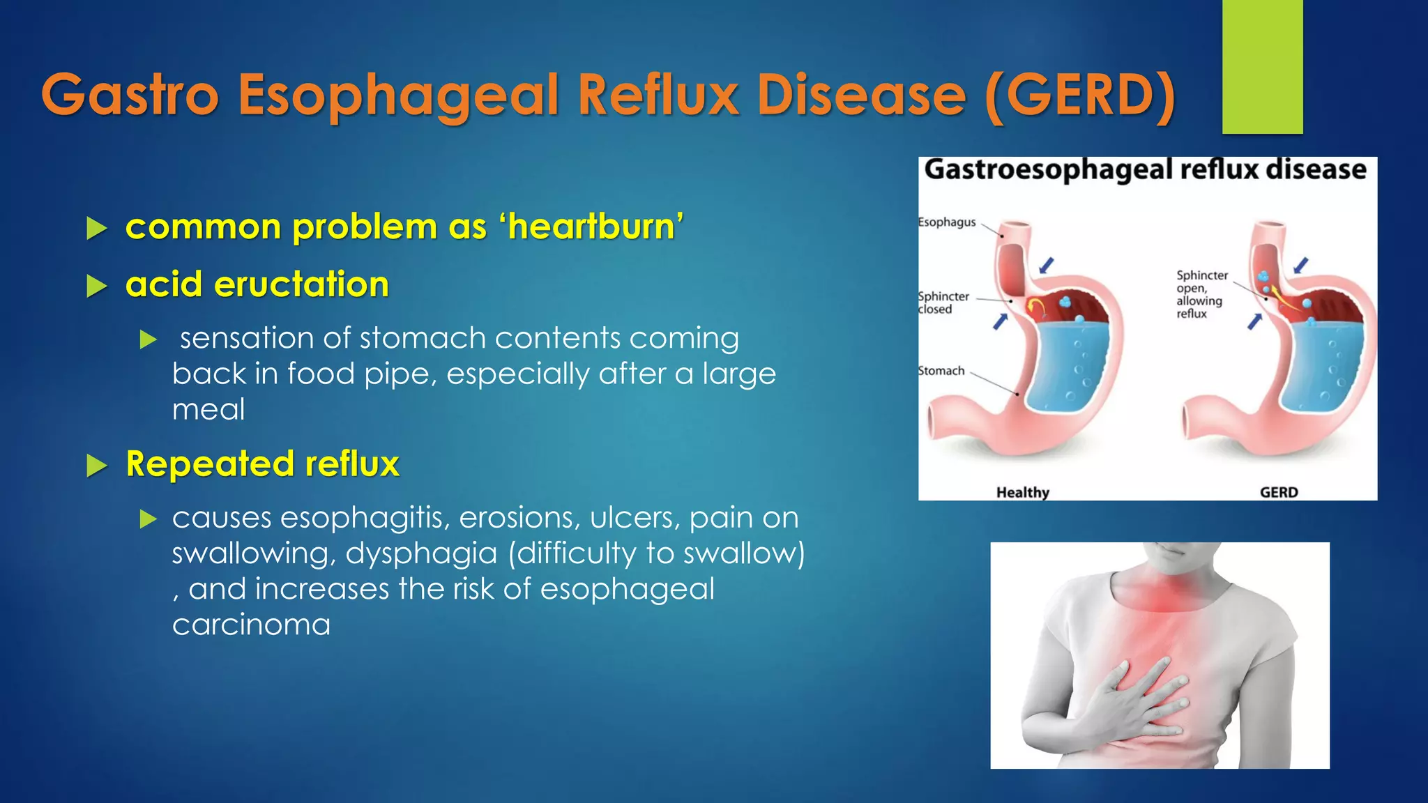 3. drugs used in gastrointestinal system | PDF