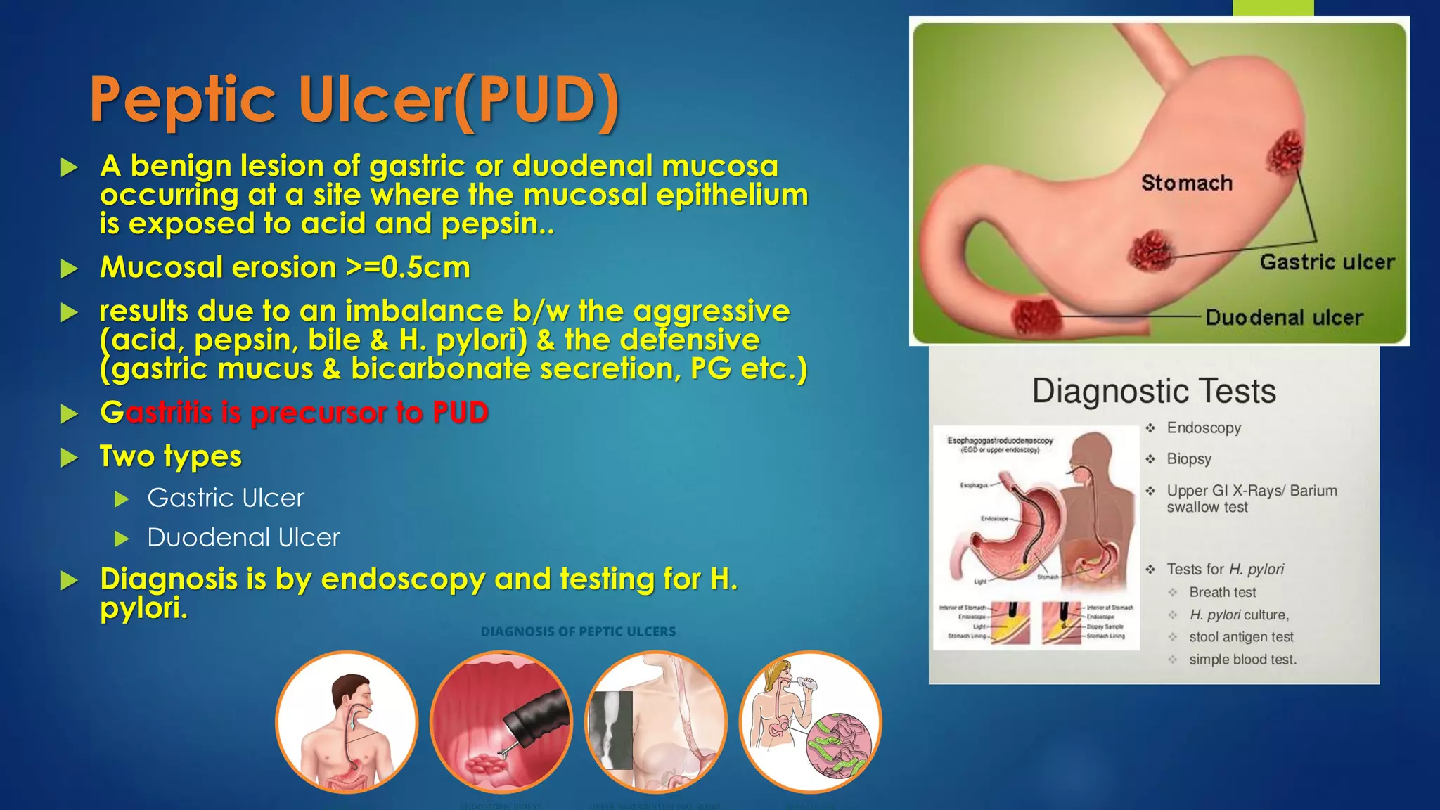 3. drugs used in gastrointestinal system | PDF