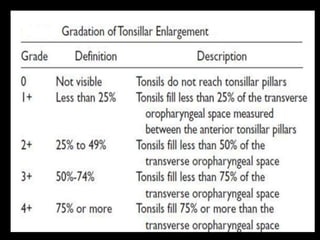Enlarged Tonsils Grading