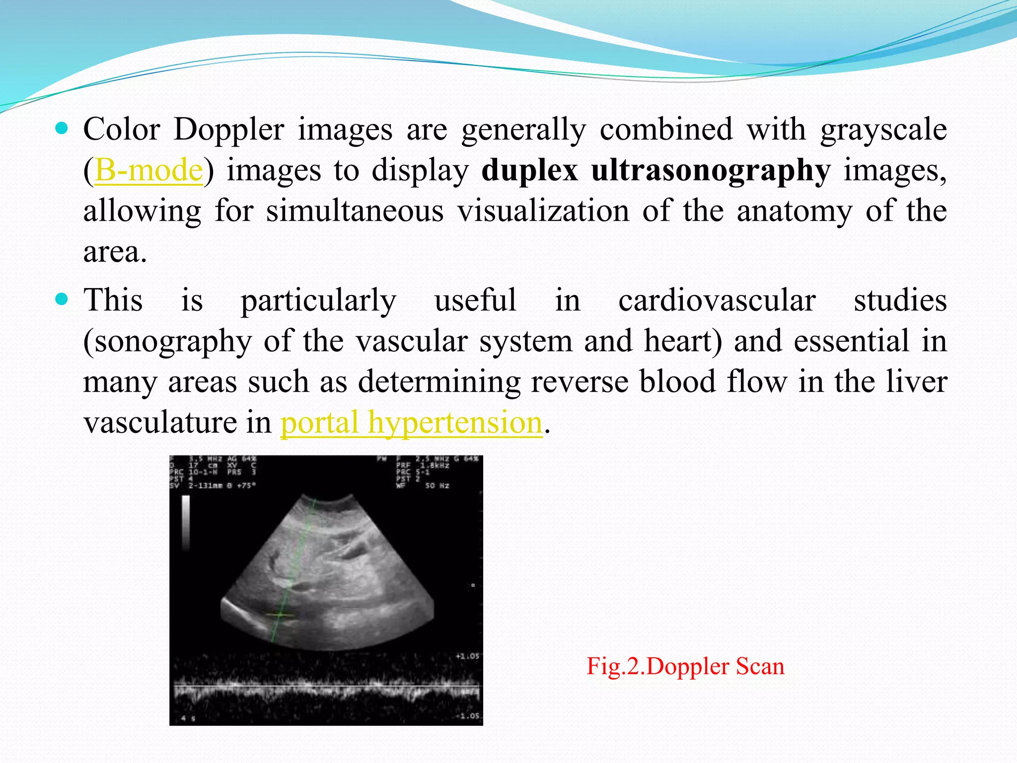 Ultra sound scan & Doppler Scan | PPT