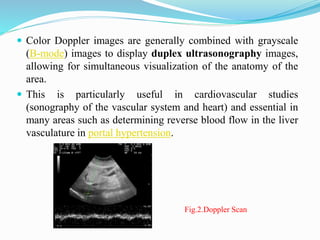 Ultra sound scan & Doppler Scan | PPT