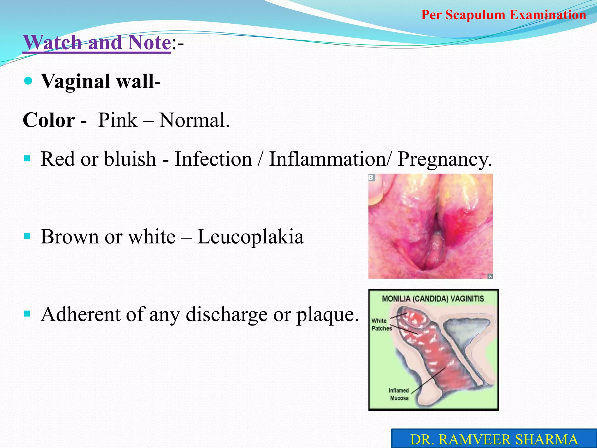 Gynaecological Examination, Per scapulum examination, Pelvic ...