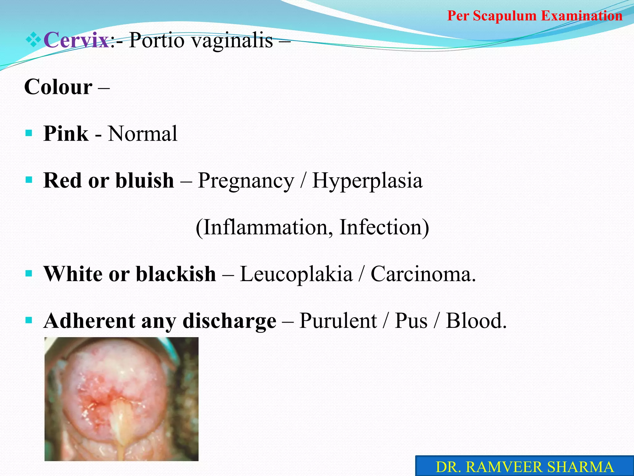 Gynaecological Examination, Per scapulum examination, Pelvic ...