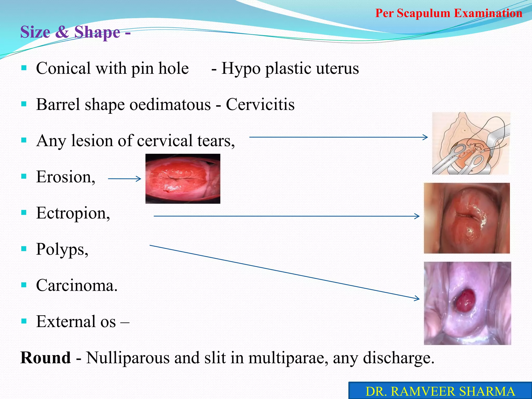 Gynaecological Examination, Per scapulum examination, Pelvic ...