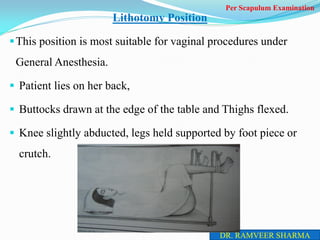 Gynaecological Examination, Per scapulum examination, Pelvic ...