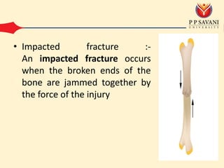 3. Fracture of Greater Tuberosity and Surgical Neck of Humerus | PPTX