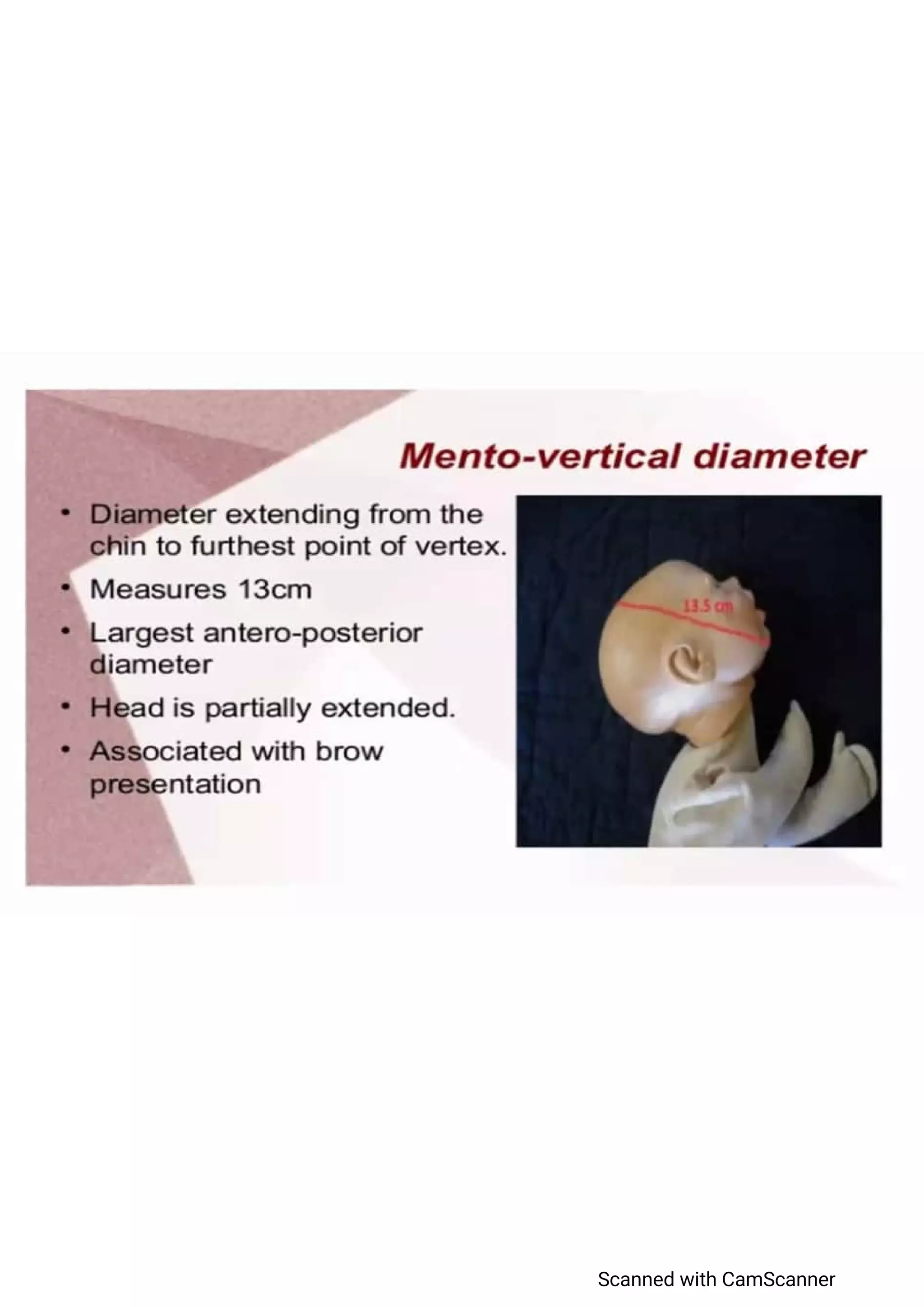 Anatomy Of Fetal Skull | PDF