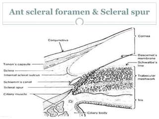 Anatomy of Sclera | PPTX