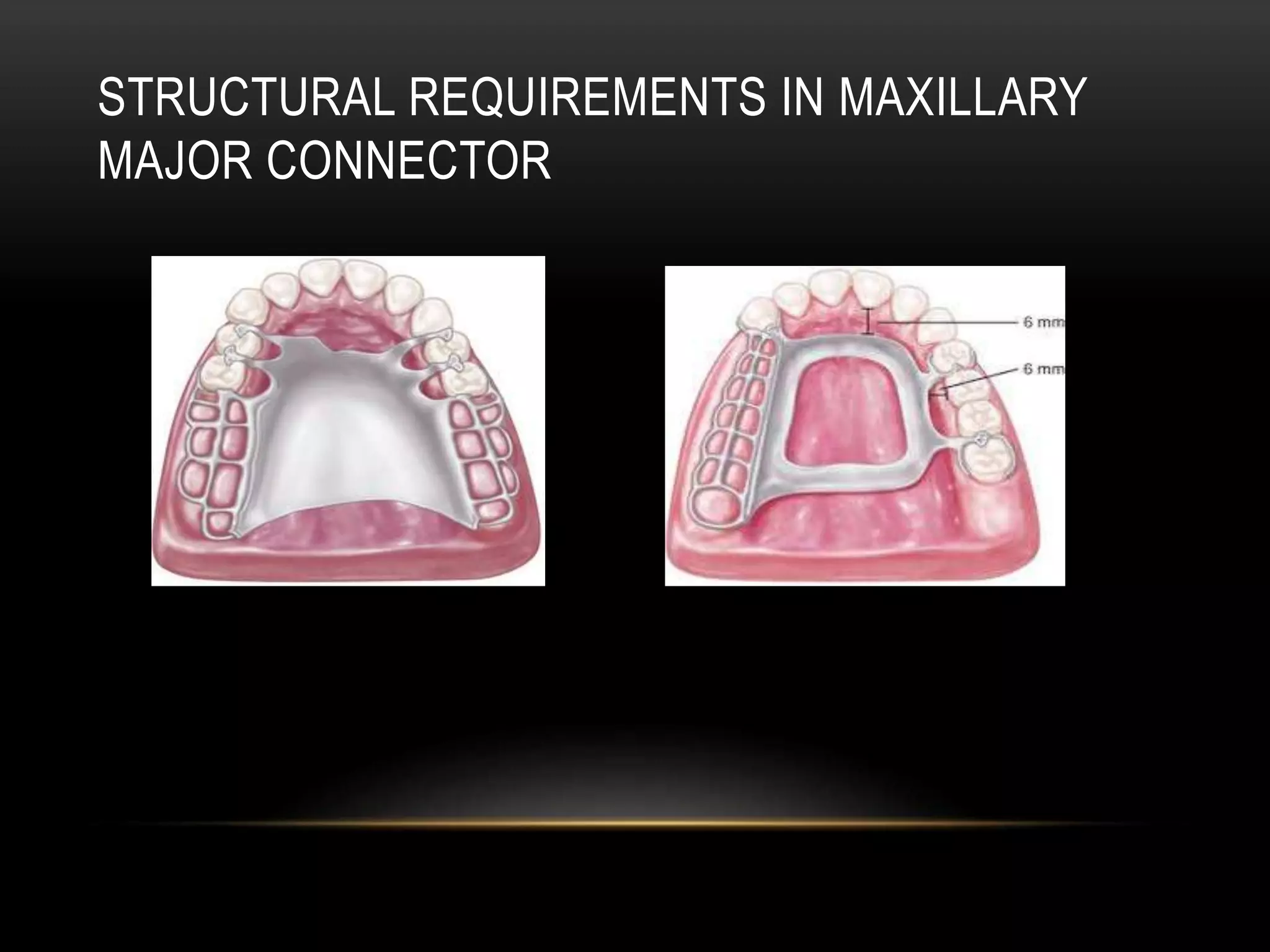 MAJOR CONNECTORS AND MINOR CONNECTORS IN RPD - Dr Prathibha Prasad | PPTX
