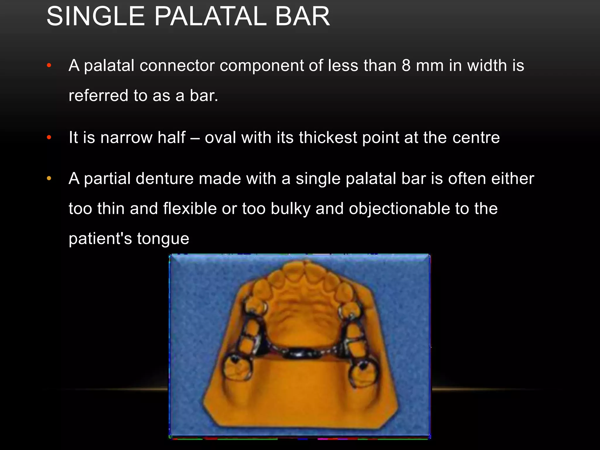 MAJOR CONNECTORS AND MINOR CONNECTORS IN RPD - Dr Prathibha Prasad | PPTX