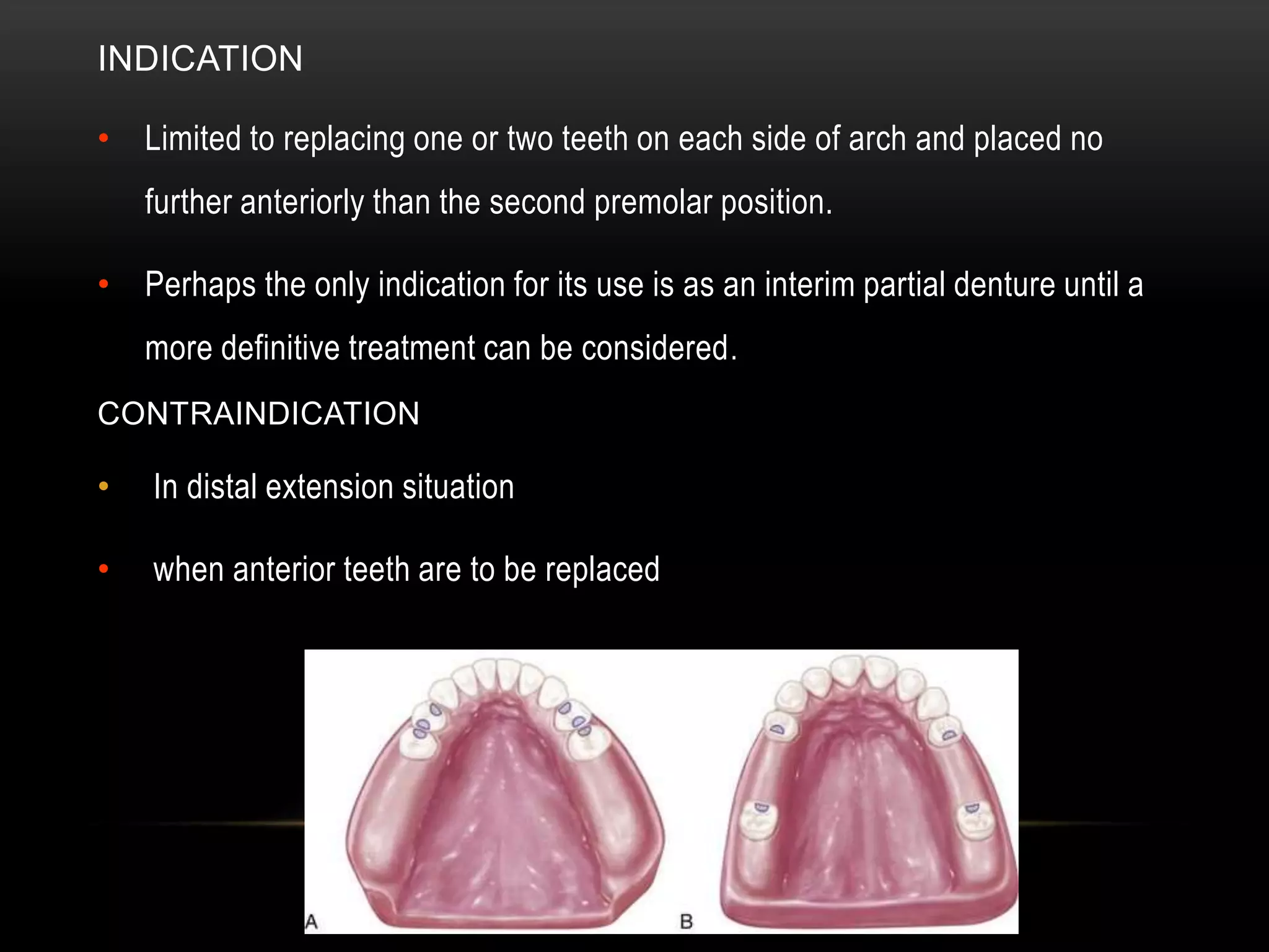 MAJOR CONNECTORS AND MINOR CONNECTORS IN RPD - Dr Prathibha Prasad | PPTX