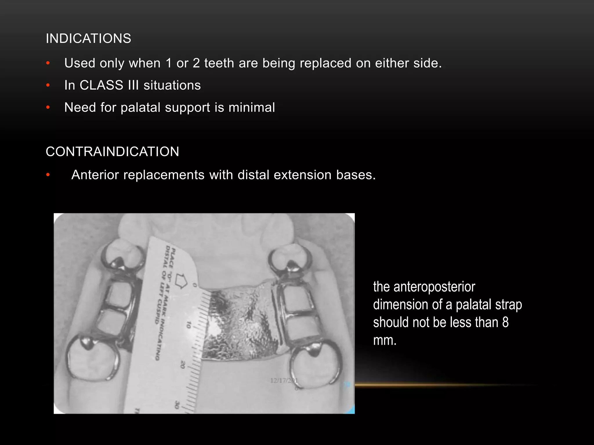 MAJOR CONNECTORS AND MINOR CONNECTORS IN RPD - Dr Prathibha Prasad | PPTX