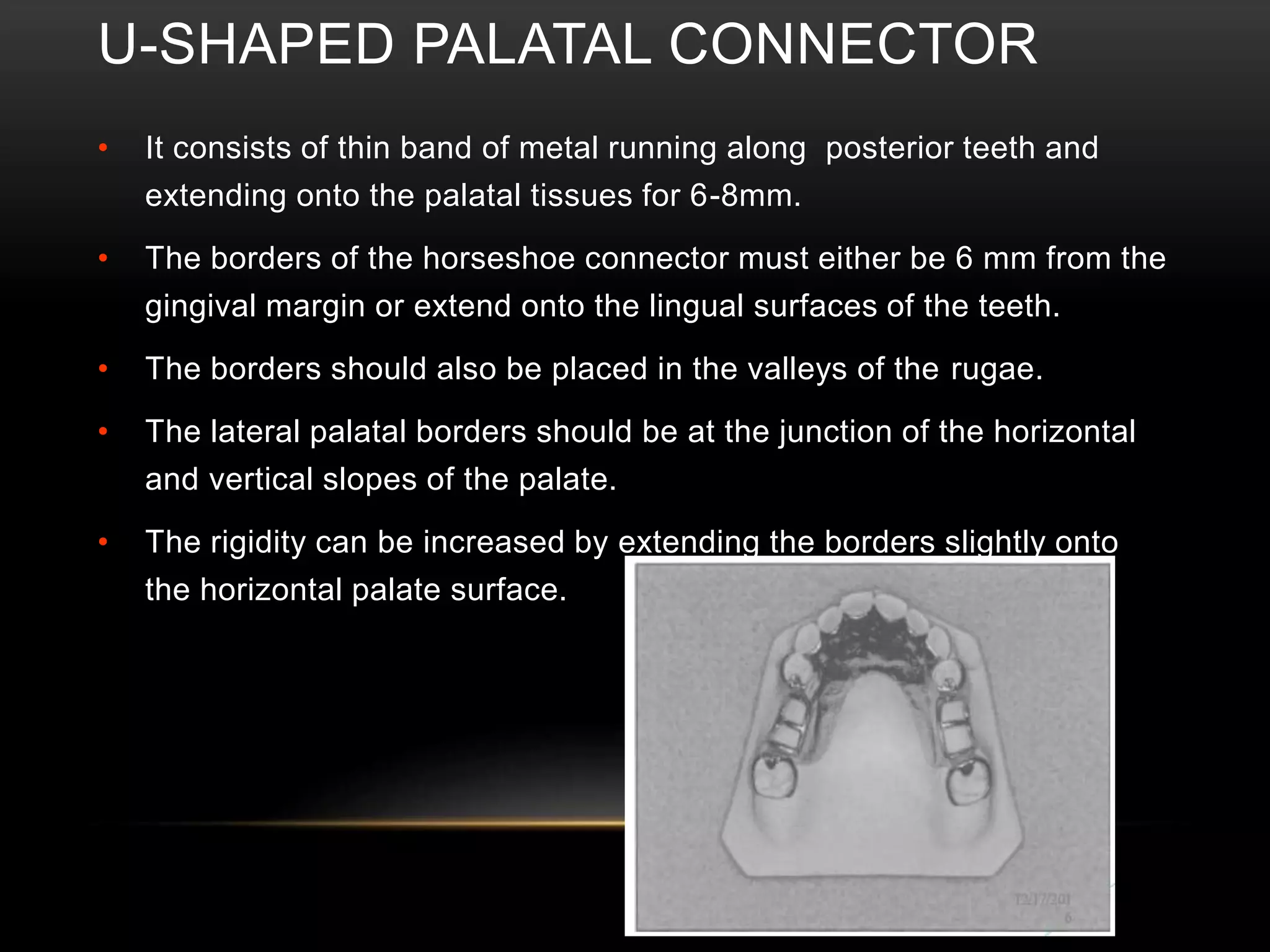 MAJOR CONNECTORS AND MINOR CONNECTORS IN RPD - Dr Prathibha Prasad ...