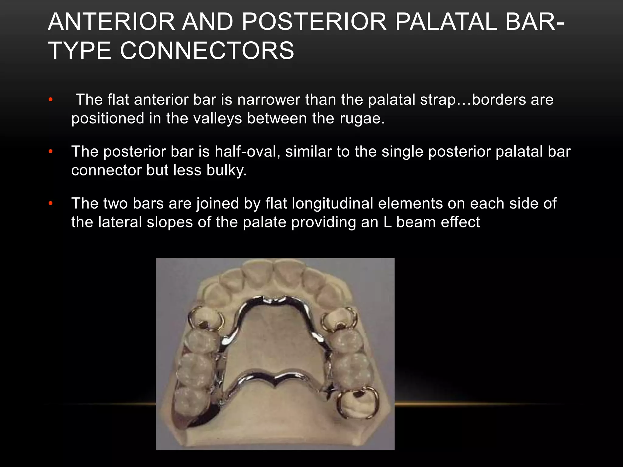 MAJOR CONNECTORS AND MINOR CONNECTORS IN RPD - Dr Prathibha Prasad ...