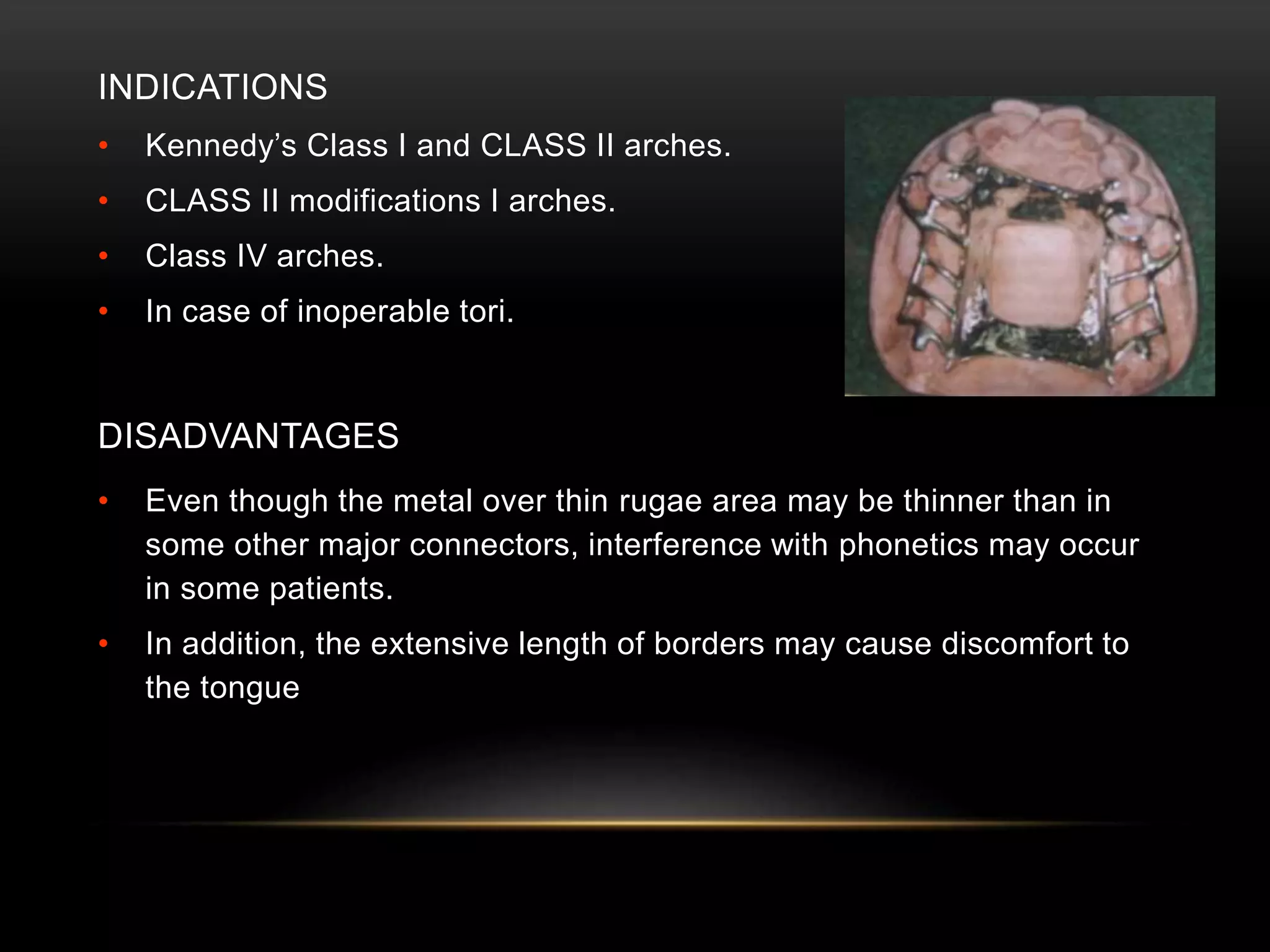 MAJOR CONNECTORS AND MINOR CONNECTORS IN RPD - Dr Prathibha Prasad | PPTX