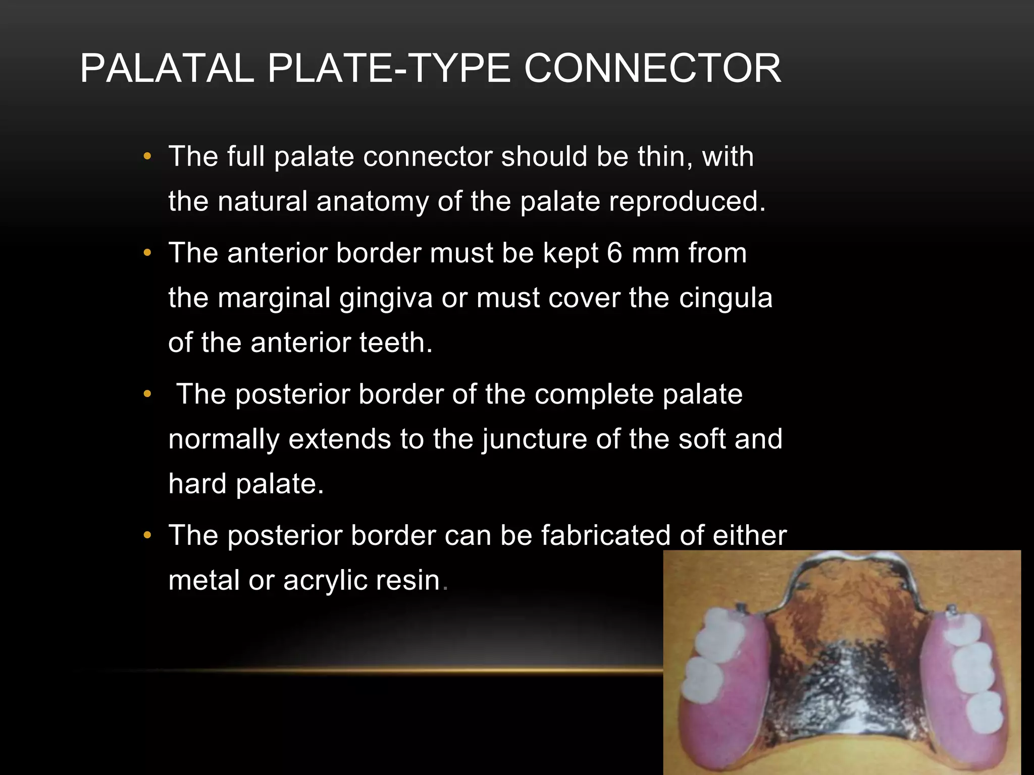 MAJOR CONNECTORS AND MINOR CONNECTORS IN RPD - Dr Prathibha Prasad | PPTX