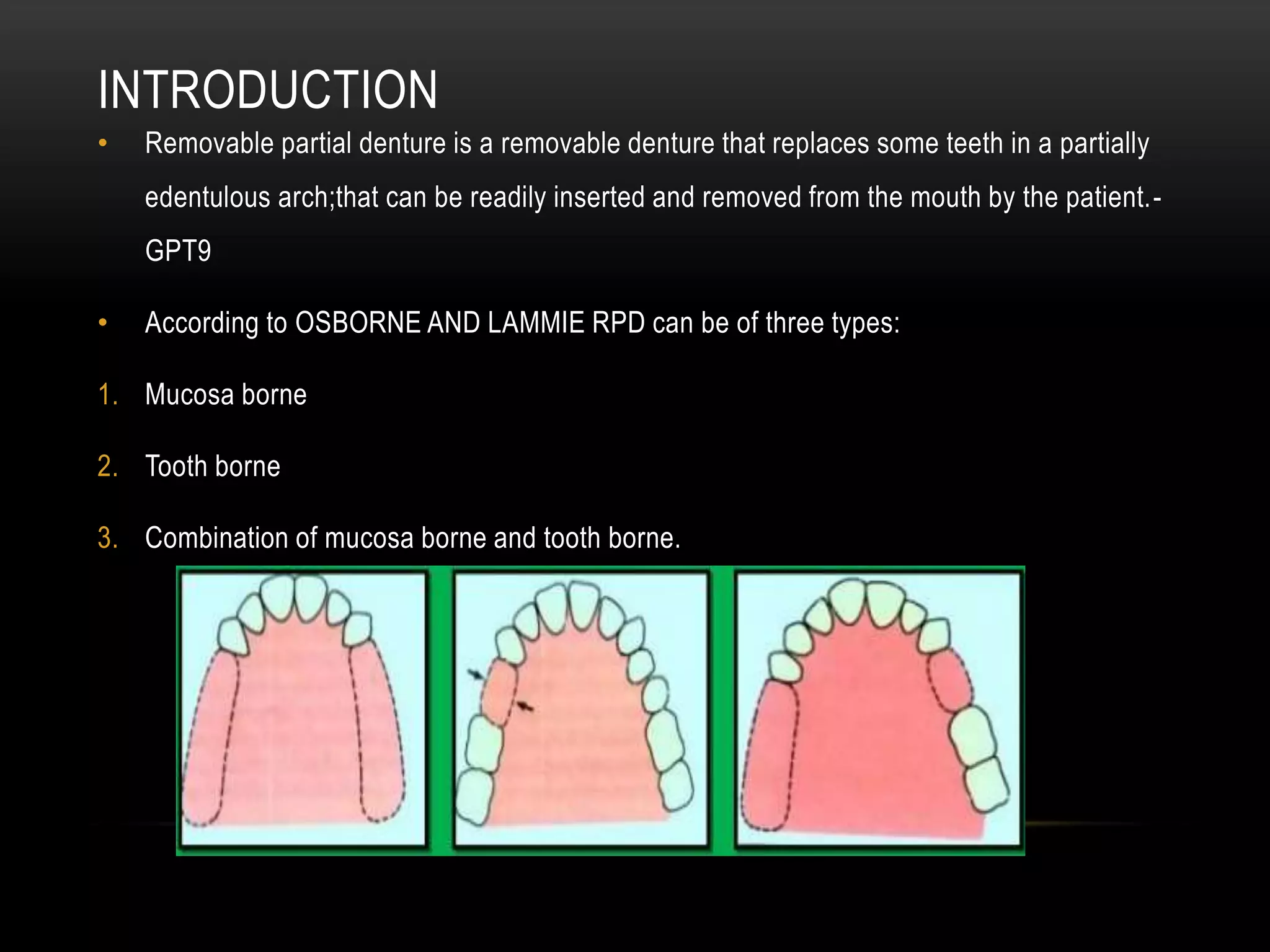 MAJOR CONNECTORS AND MINOR CONNECTORS IN RPD - Dr Prathibha Prasad | PPTX