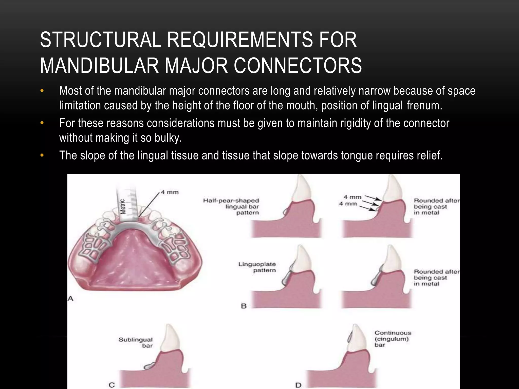 MAJOR CONNECTORS AND MINOR CONNECTORS IN RPD - Dr Prathibha Prasad | PPTX
