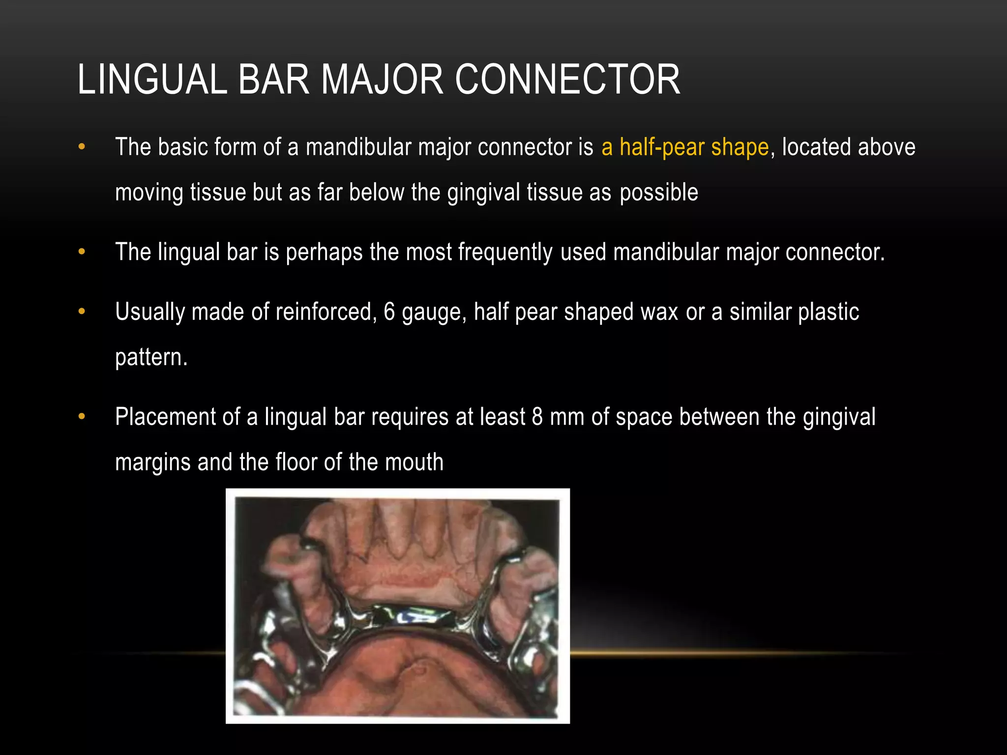 MAJOR CONNECTORS AND MINOR CONNECTORS IN RPD - Dr Prathibha Prasad | PPTX