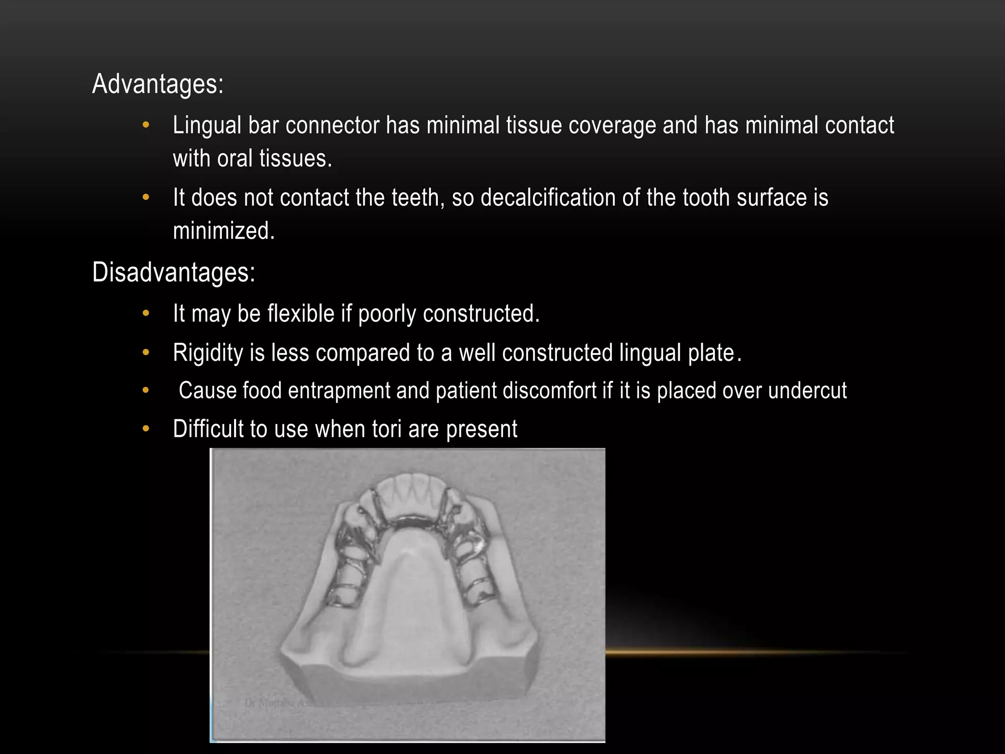 MAJOR CONNECTORS AND MINOR CONNECTORS IN RPD - Dr Prathibha Prasad | PPTX