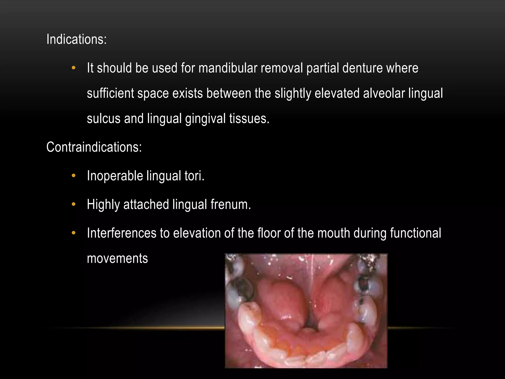 MAJOR CONNECTORS AND MINOR CONNECTORS IN RPD - Dr Prathibha Prasad | PPTX