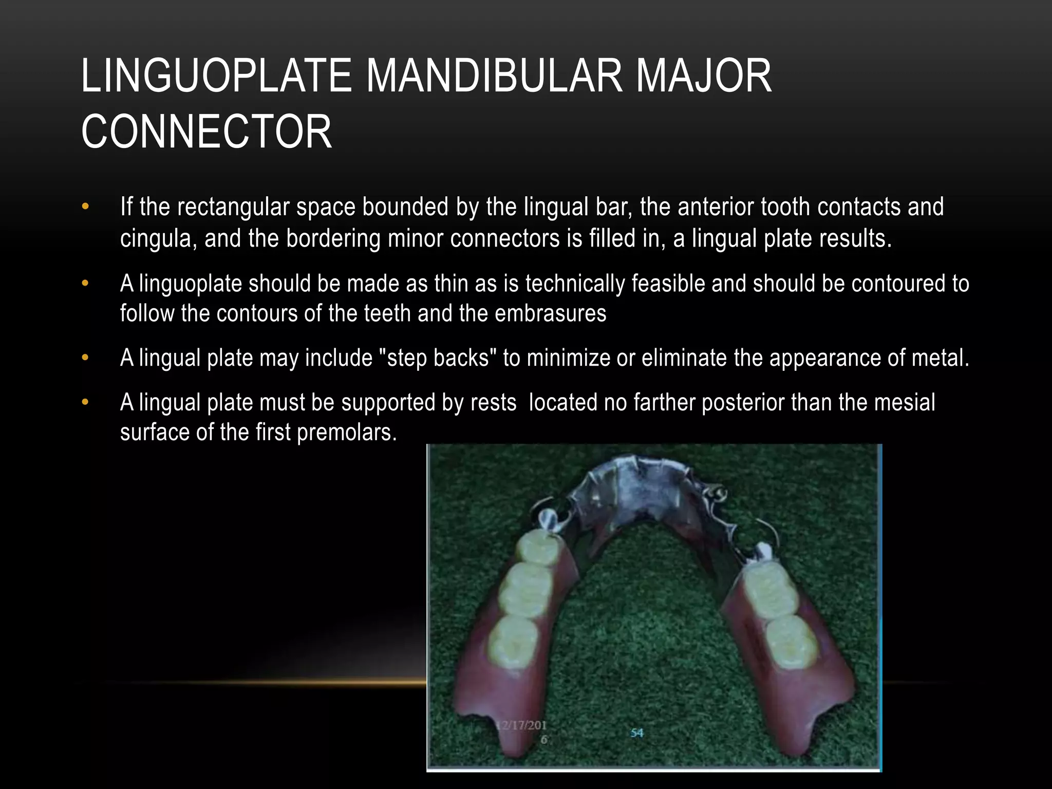 MAJOR CONNECTORS AND MINOR CONNECTORS IN RPD - Dr Prathibha Prasad ...
