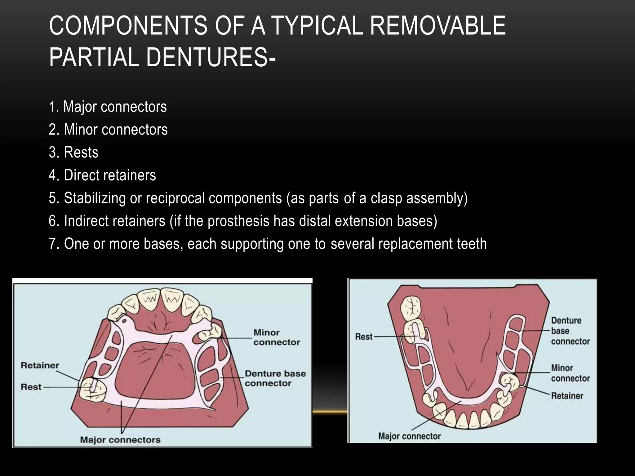 MAJOR CONNECTORS AND MINOR CONNECTORS IN RPD - Dr Prathibha Prasad | PPTX