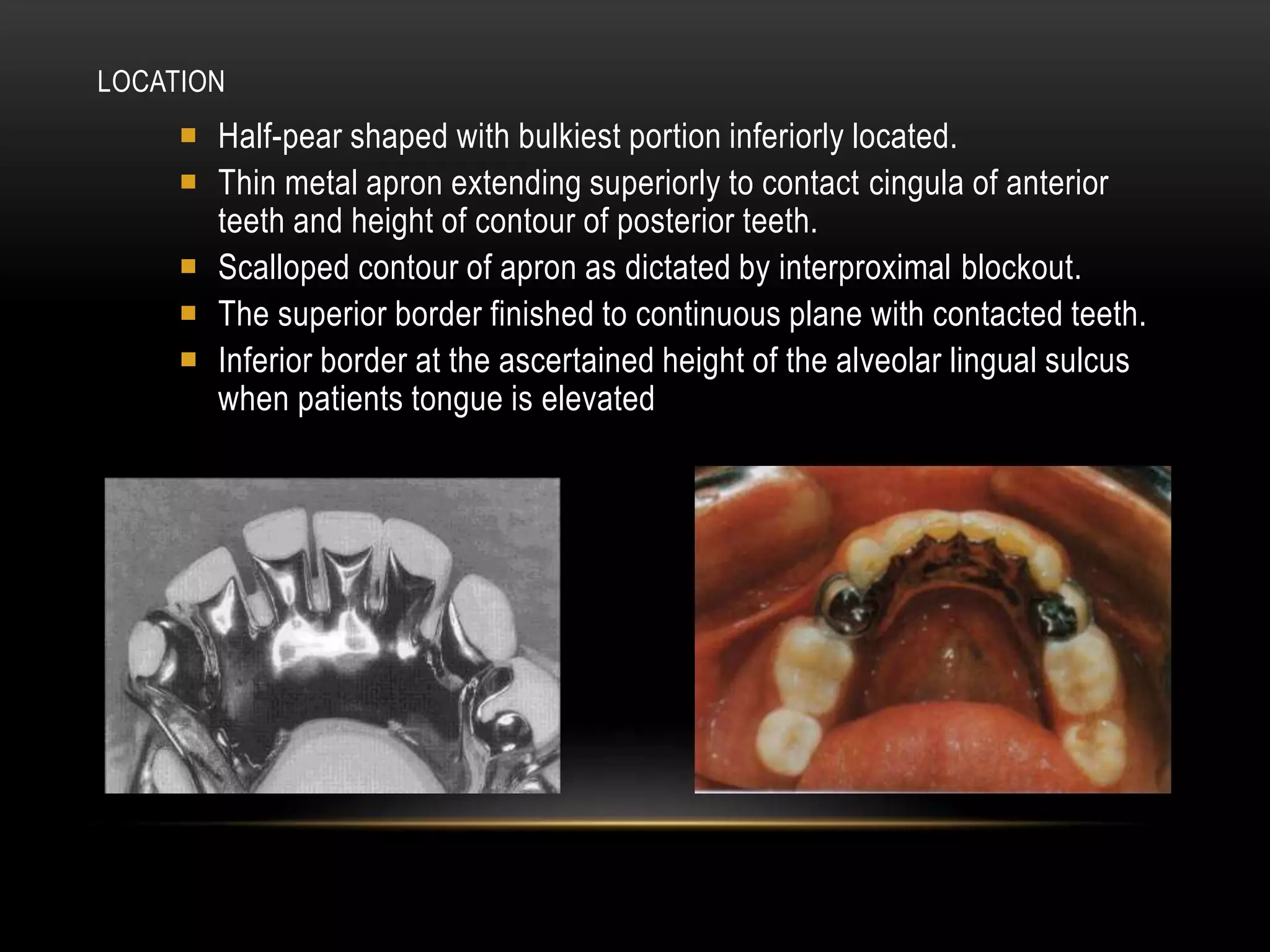 MAJOR CONNECTORS AND MINOR CONNECTORS IN RPD - Dr Prathibha Prasad | PPTX