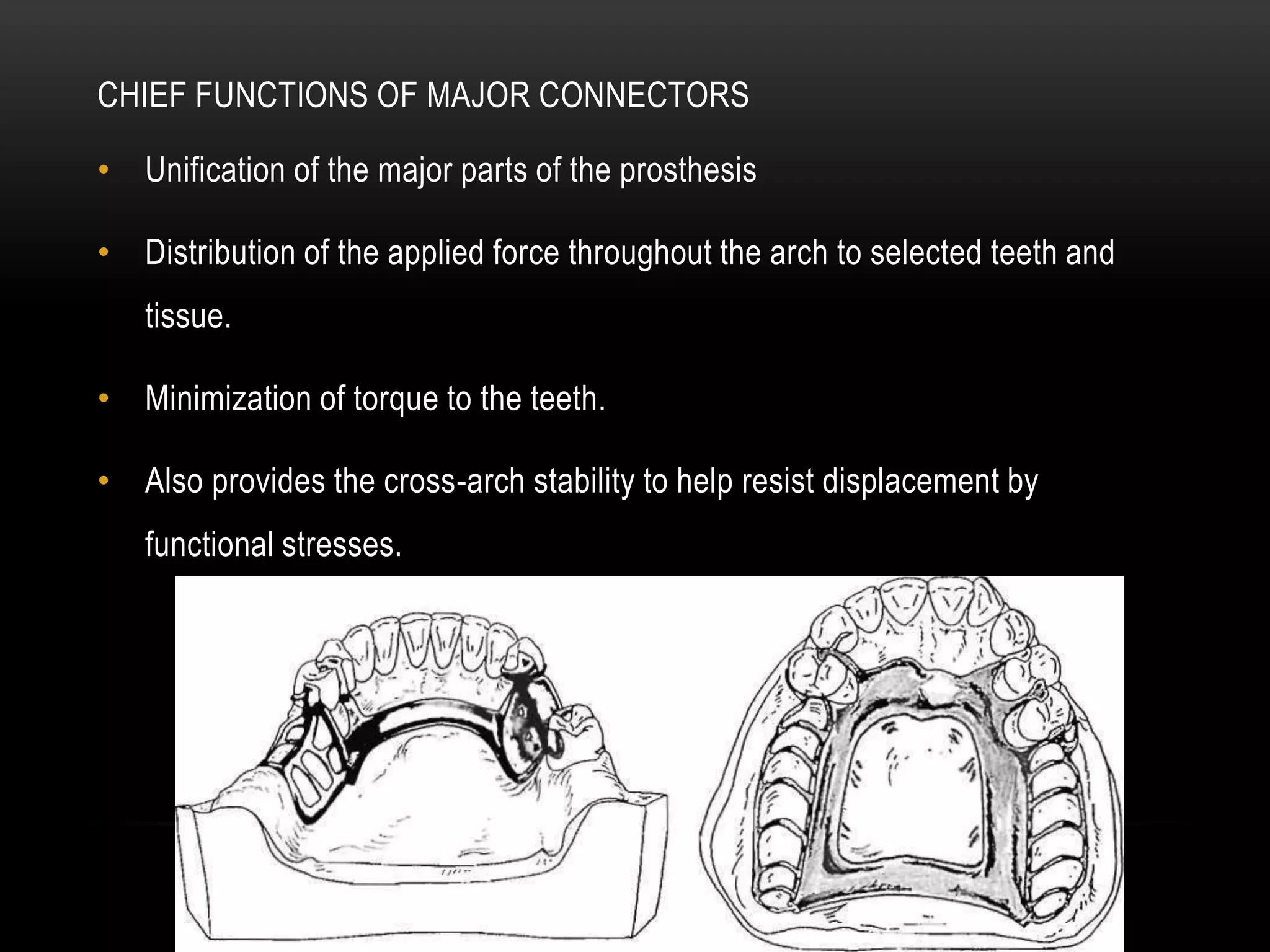 MAJOR CONNECTORS AND MINOR CONNECTORS IN RPD - Dr Prathibha Prasad | PPTX