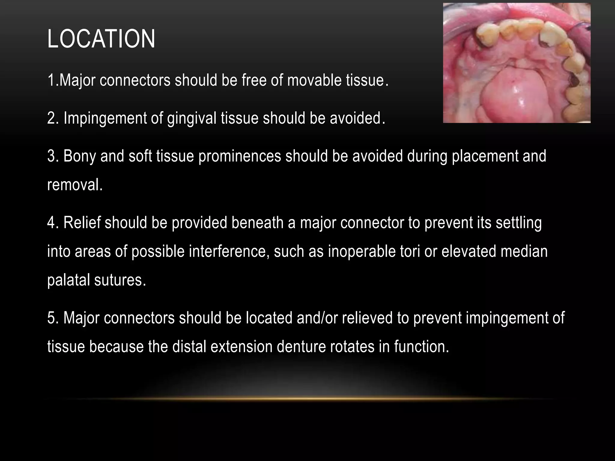 MAJOR CONNECTORS AND MINOR CONNECTORS IN RPD - Dr Prathibha Prasad | PPTX