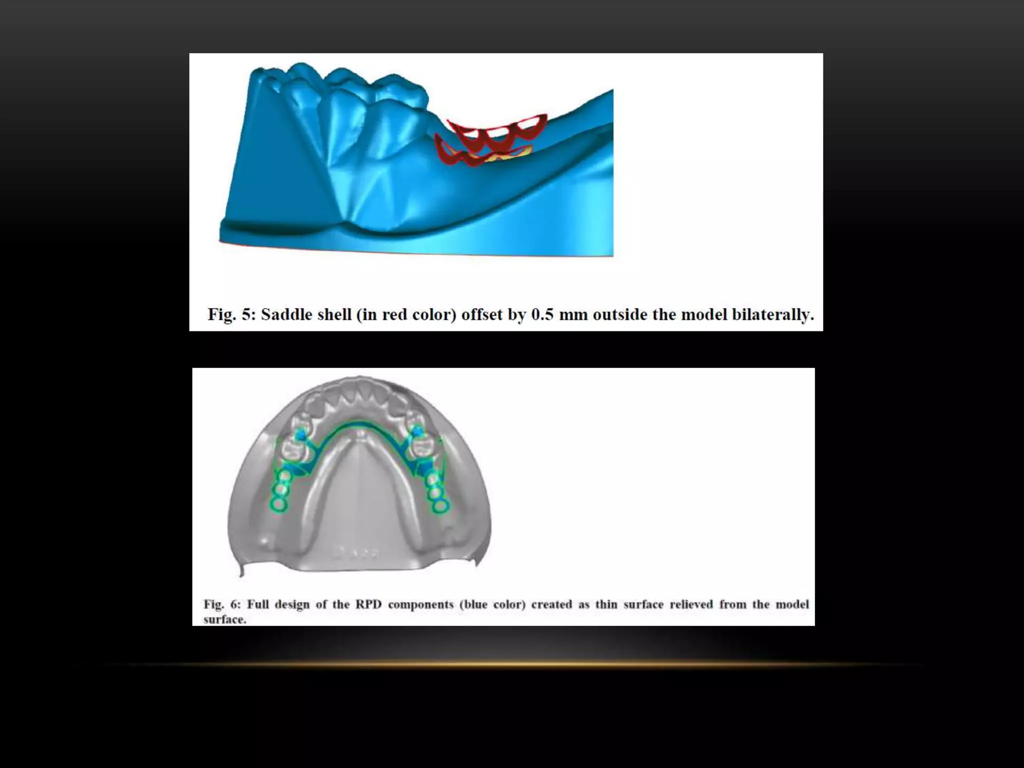 MAJOR CONNECTORS AND MINOR CONNECTORS IN RPD - Dr Prathibha Prasad | PPTX
