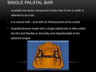 MAJOR CONNECTORS AND MINOR CONNECTORS IN RPD - Dr Prathibha Prasad | PPTX