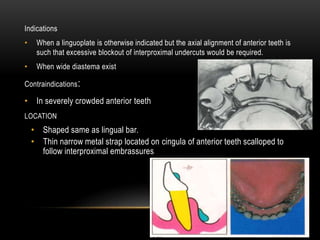 MAJOR CONNECTORS AND MINOR CONNECTORS IN RPD - Dr Prathibha Prasad | PPTX
