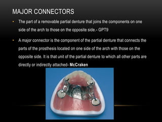 MAJOR CONNECTORS AND MINOR CONNECTORS IN RPD - Dr Prathibha Prasad | PPTX