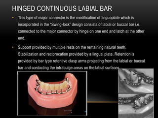 MAJOR CONNECTORS AND MINOR CONNECTORS IN RPD - Dr Prathibha Prasad | PPTX