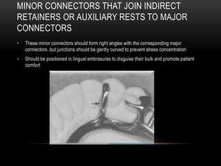 MAJOR CONNECTORS AND MINOR CONNECTORS IN RPD - Dr Prathibha Prasad | PPTX
