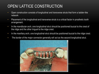 MAJOR CONNECTORS AND MINOR CONNECTORS IN RPD - Dr Prathibha Prasad | PPTX
