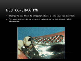 MAJOR CONNECTORS AND MINOR CONNECTORS IN RPD - Dr Prathibha Prasad | PPTX