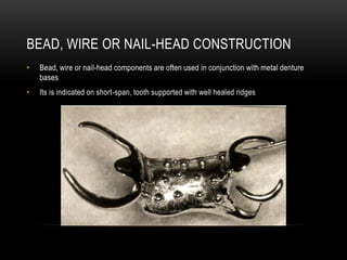 MAJOR CONNECTORS AND MINOR CONNECTORS IN RPD - Dr Prathibha Prasad | PPTX