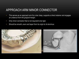 MAJOR CONNECTORS AND MINOR CONNECTORS IN RPD - Dr Prathibha Prasad | PPTX