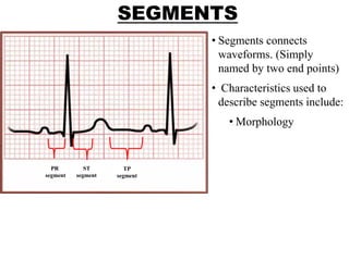 3. ecg basics waveforms, segments, intervals | PPTX