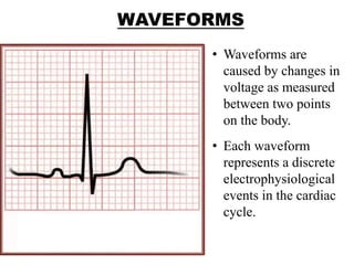 3. ecg basics waveforms, segments, intervals | PPTX