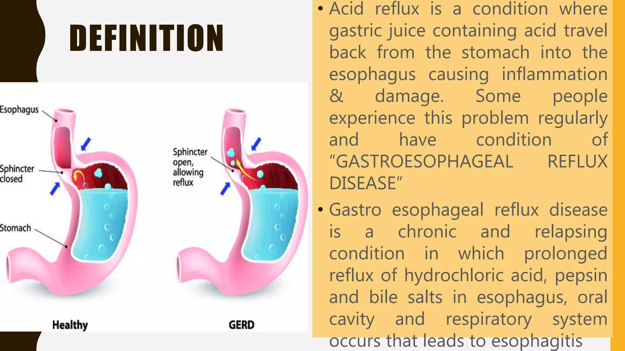 DISORDERS OF ESOPHAGUS | PPTX