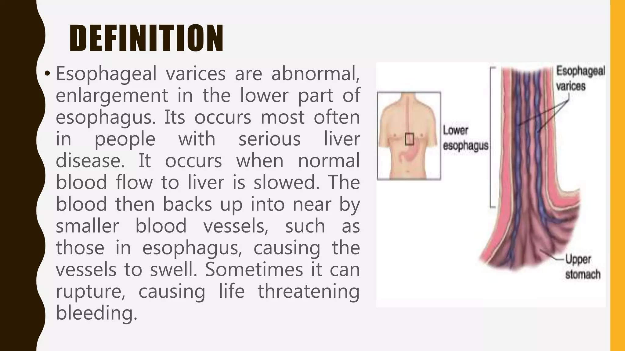 DISORDERS OF ESOPHAGUS | PPTX