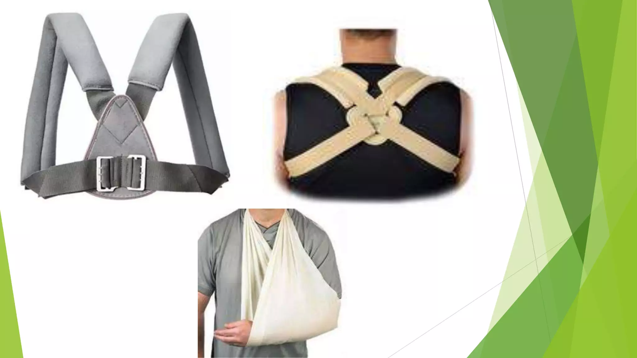 Clavicle fracture and its management | PPTX
