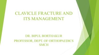 Clavicle fracture and its management | PPTX