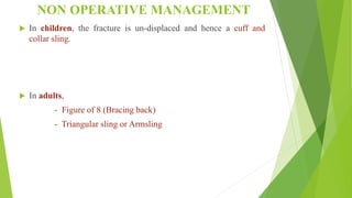 Clavicle fracture and its management | PPTX