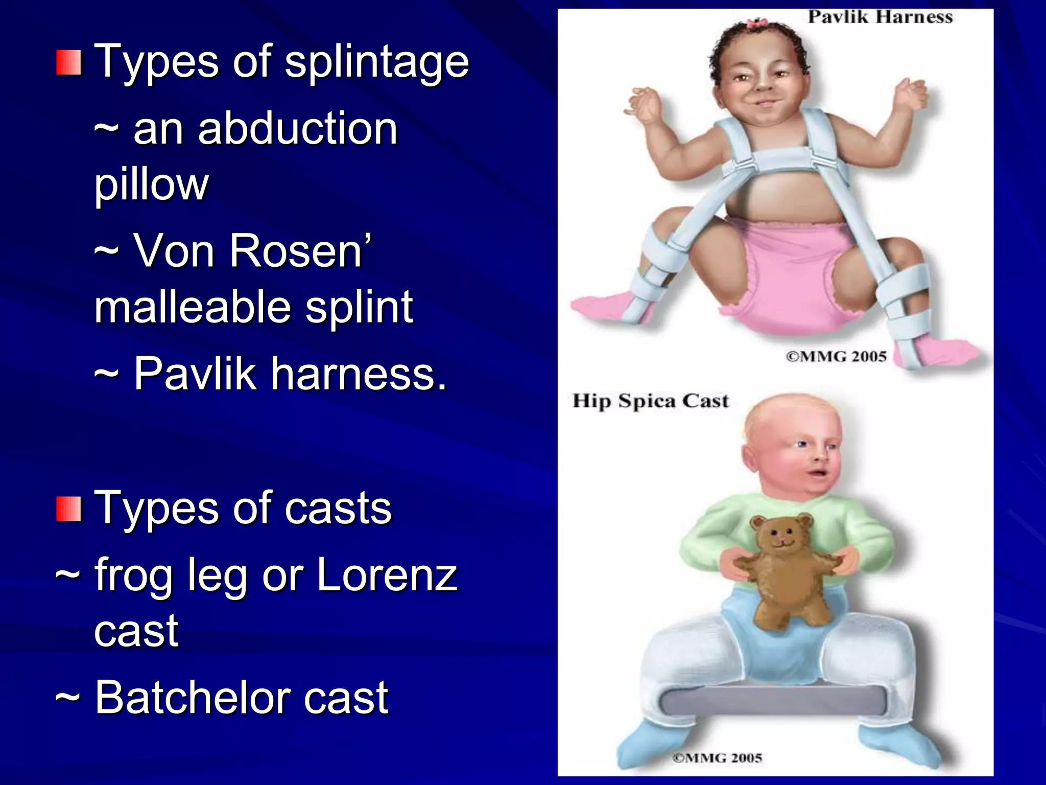 Developmental Dysplasia Of Hip | PPT