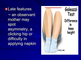 Developmental Dysplasia Of Hip | PPT